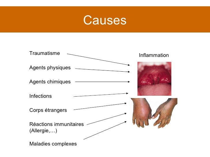 Cours 5 - Inflammation (Partie 1)