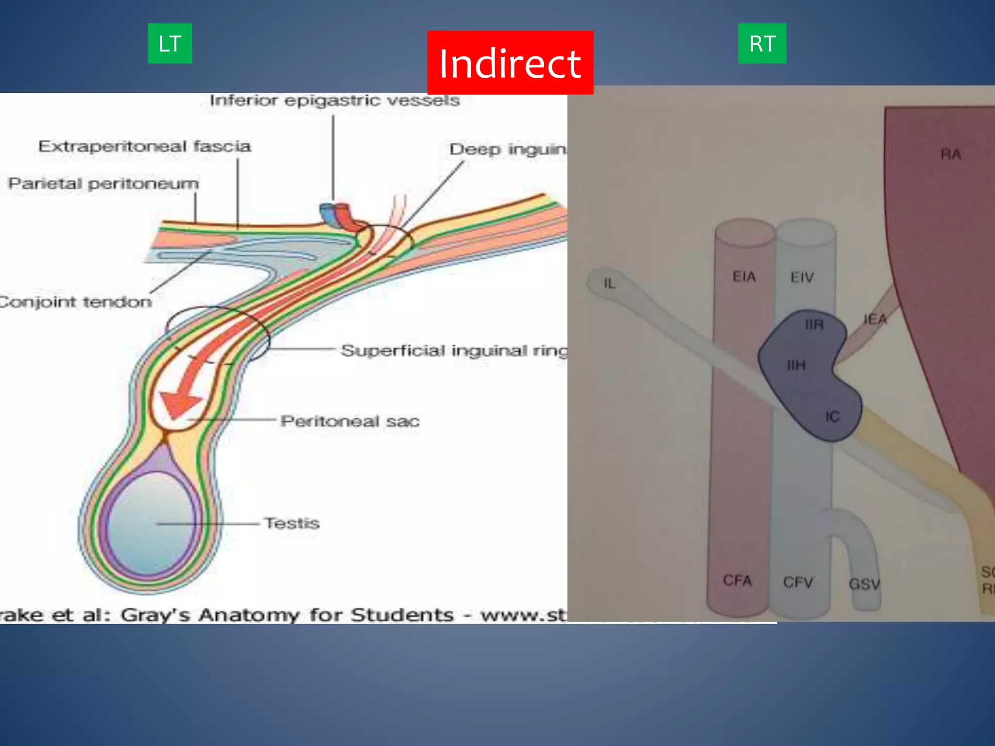 Imaging of Inguino scrotal region | PPTX
