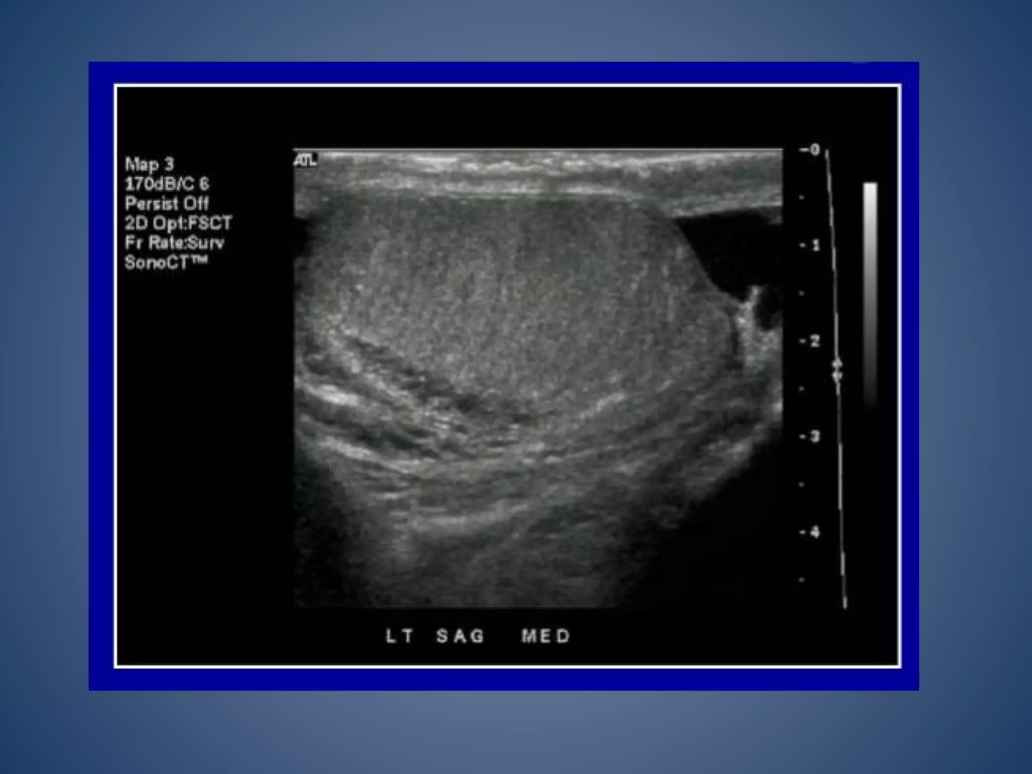 Imaging of Inguino scrotal region | PPTX