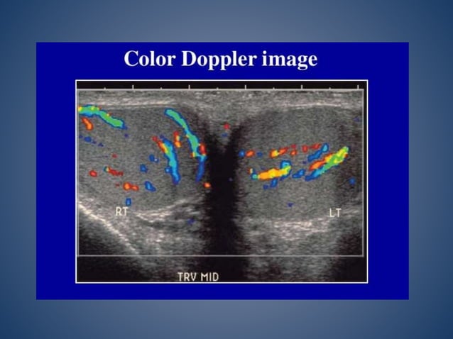 Imaging of Inguino scrotal region | PPTX