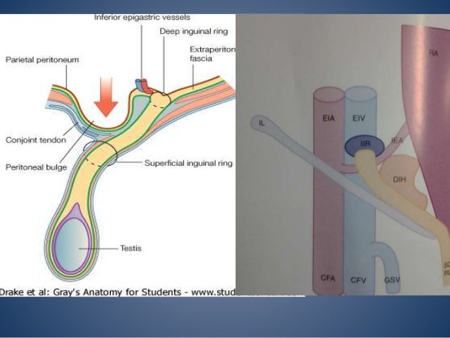 Imaging of Inguino scrotal region