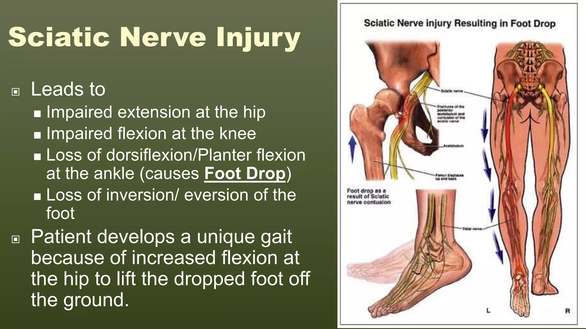 5 Injuries of the Lower Limb.pptx