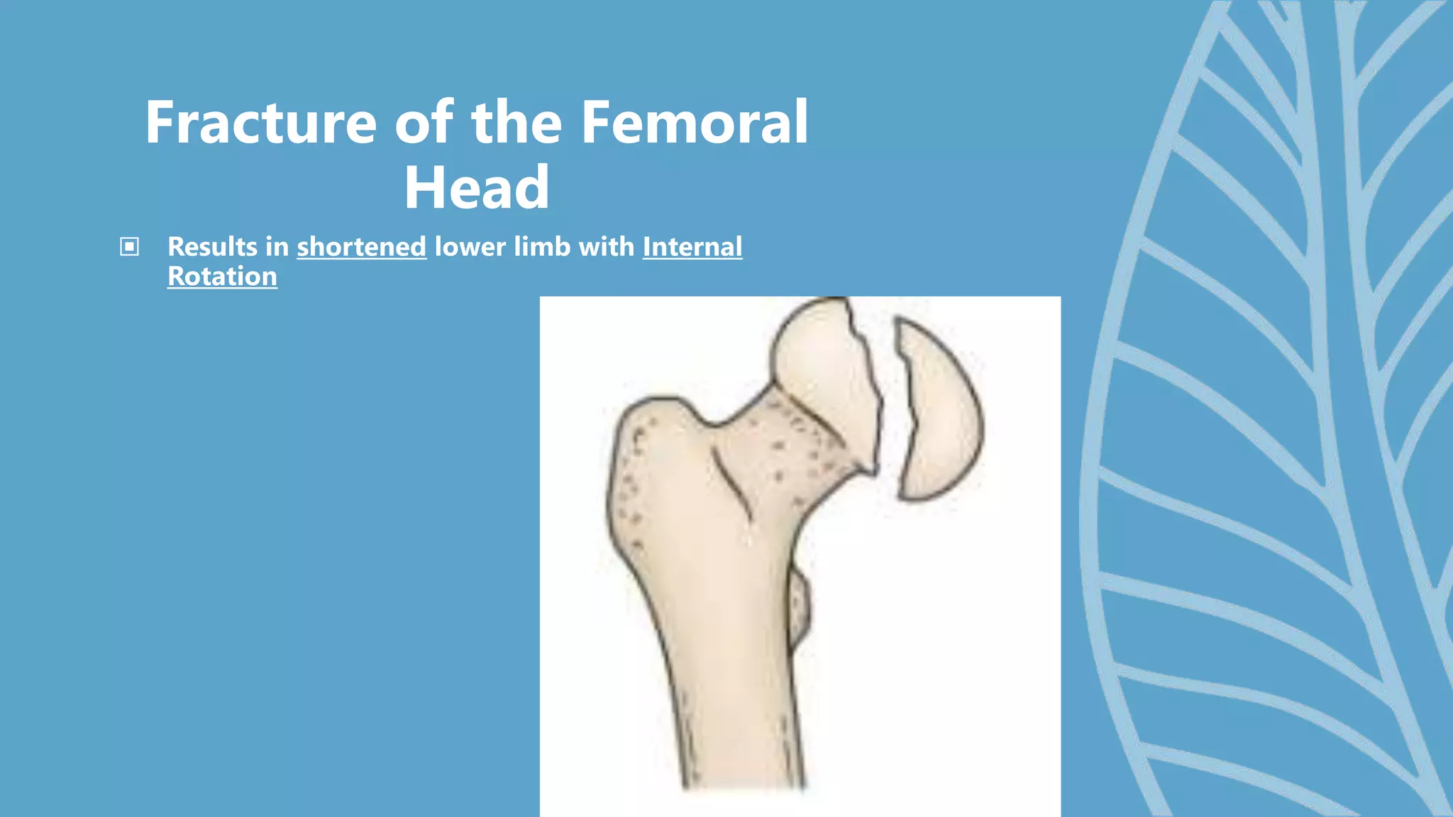 5 Injuries of the Lower Limb.pptx
