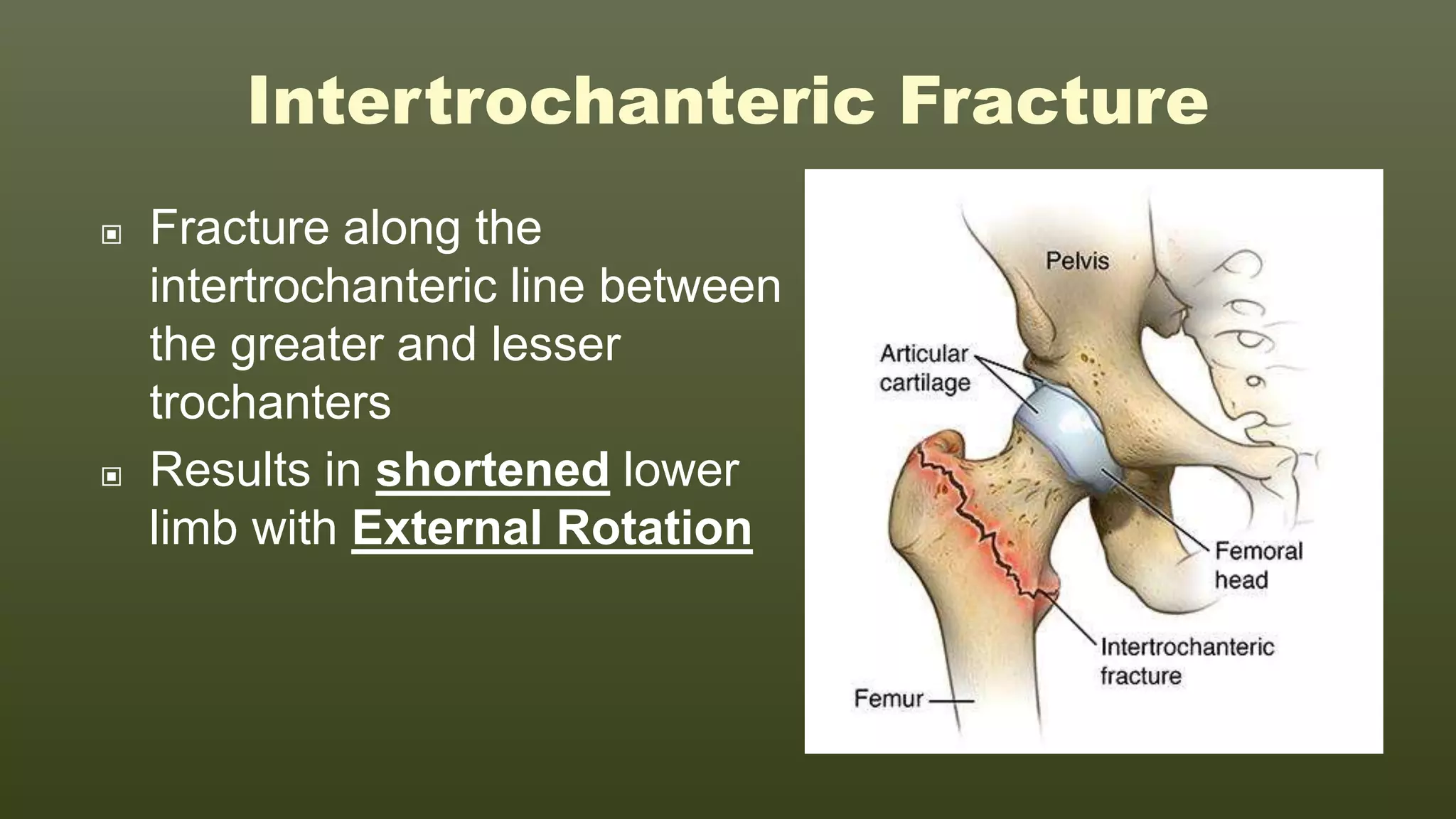 5 Injuries of the Lower Limb.pptx