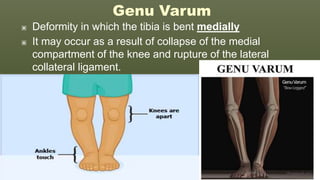 5 Injuries of the Lower Limb.pptx