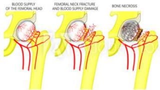 5 Injuries of the Lower Limb.pptx