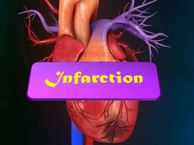 5 Ischemia Infarction & Gangrene in pathology.pptx