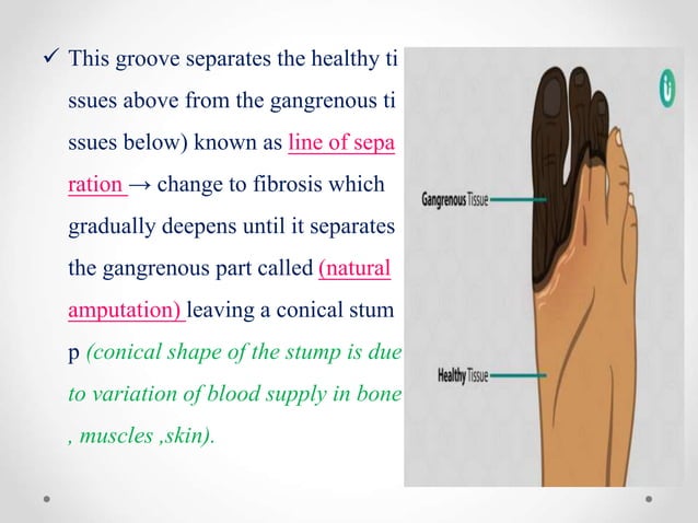 5 Ischemia Infarction & Gangrene in pathology.pptx
