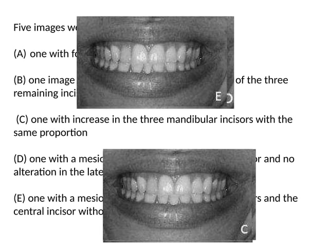 5 JC - mandibular incisor extraction .pptx