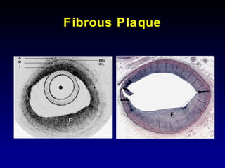 Optical coherence tomography optical biopsy with a short photonic ...