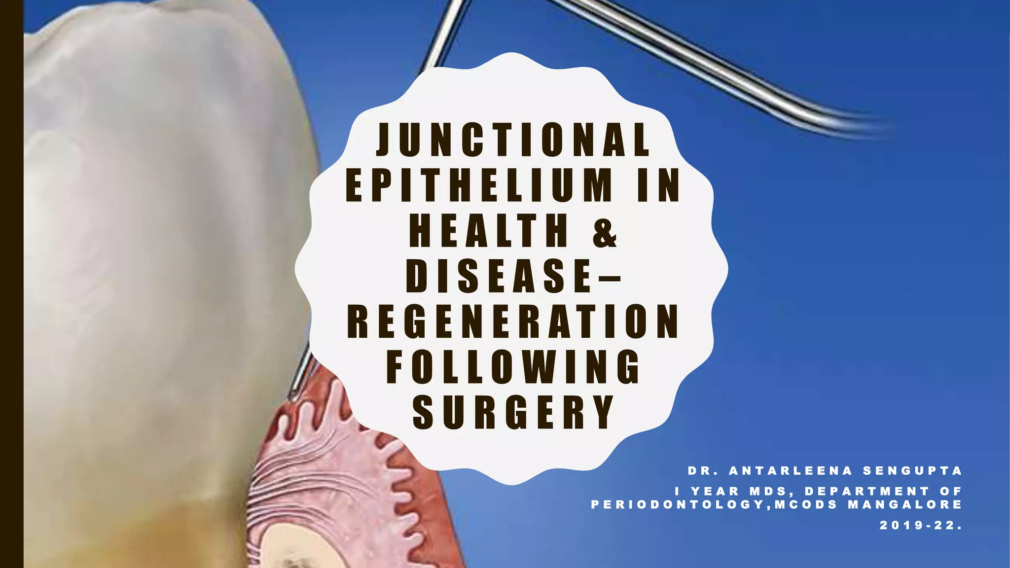 JUNCTIONAL EPITHELIUM IN HEALTH & DISEASE-- REGENERATION FOLLOWING ...