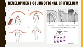 JUNCTIONAL EPITHELIUM IN HEALTH & DISEASE-- REGENERATION FOLLOWING ...