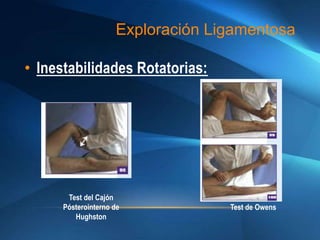 Exploracion Semiologica de la aarticulacion de la rodilla | PPTX