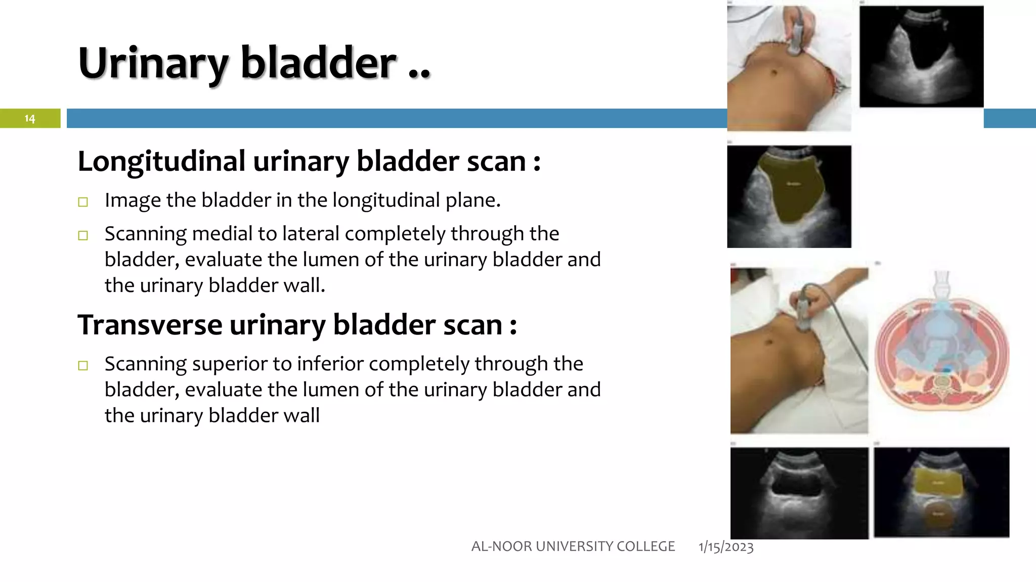 ultrasound of kidneys | PPTX