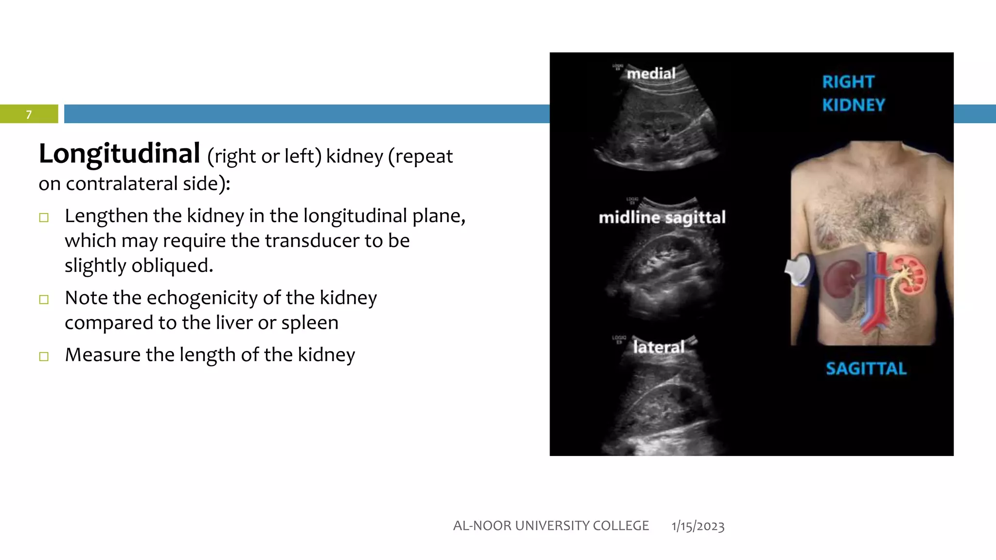 ultrasound of kidneys | PPTX