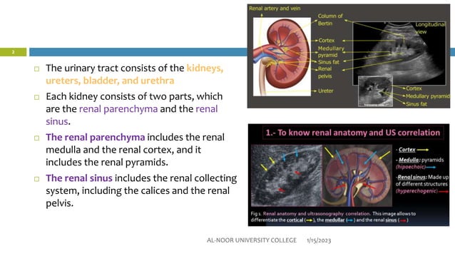 ultrasound of kidneys | PPTX