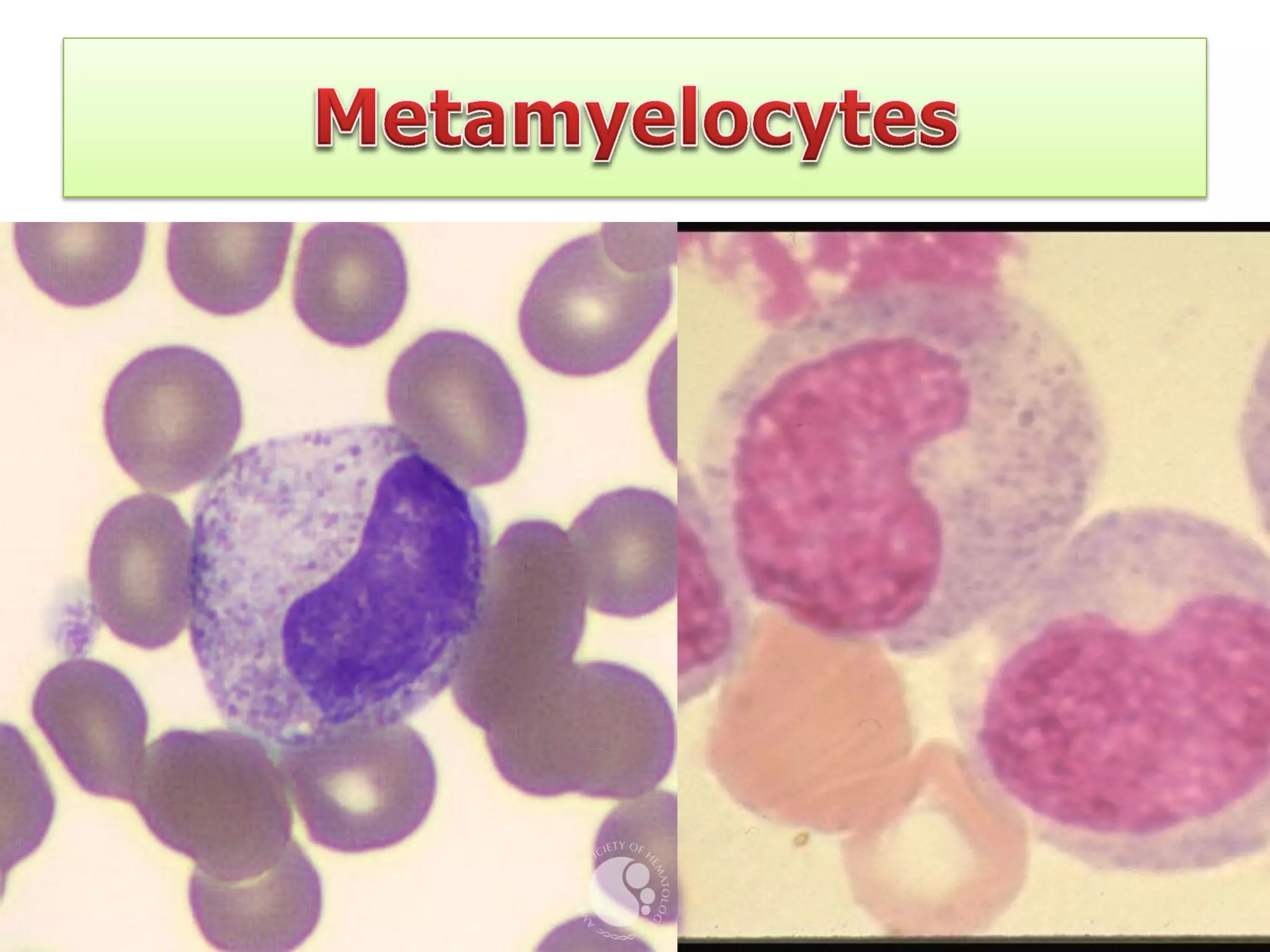 5 Leukopoiesis (1).pdf