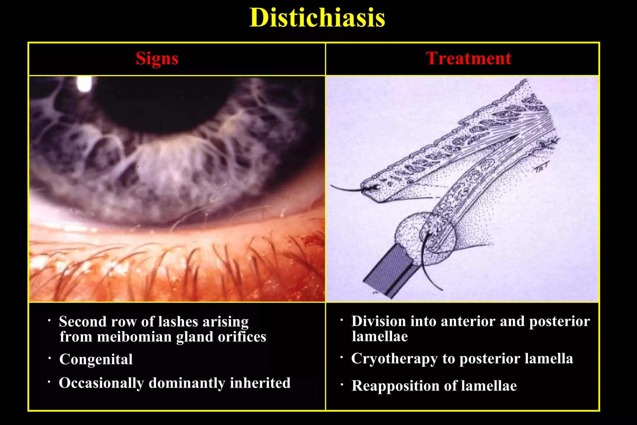 01 disorders of lashes | PPT