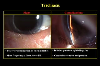 01 disorders of lashes | PPT