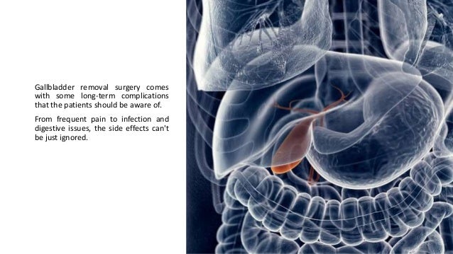 5 Long-Term Side Effects of Gallbladder Removal You Need to Know | PPTX