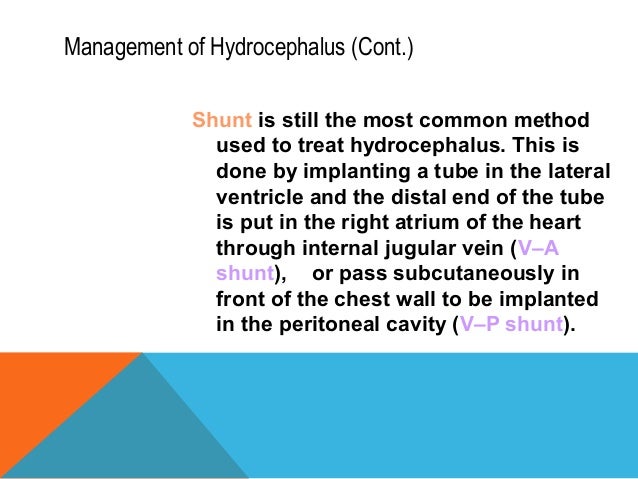 5 Methods Of Hydrocephalus Treatment