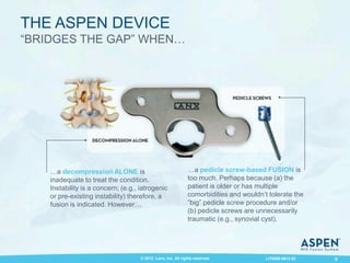 5 minute aspen sales pitch lit6200 0612 rev02 | PPT