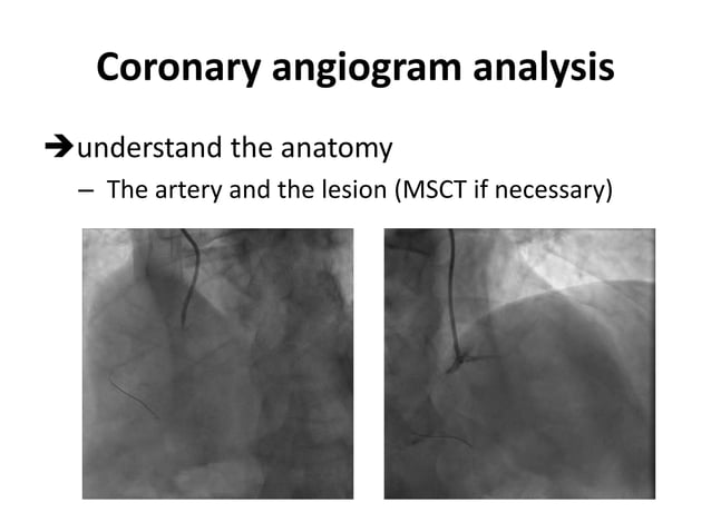 5 most important things you can do wrong in the antegrade approach | PPT