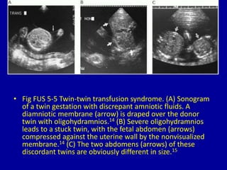 Octuplet Ultrasound