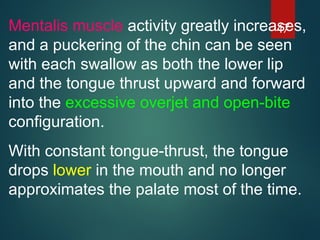 Muscles,Malformation And Malocclusion.ppt