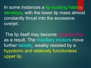 Muscles,Malformation And Malocclusion.ppt