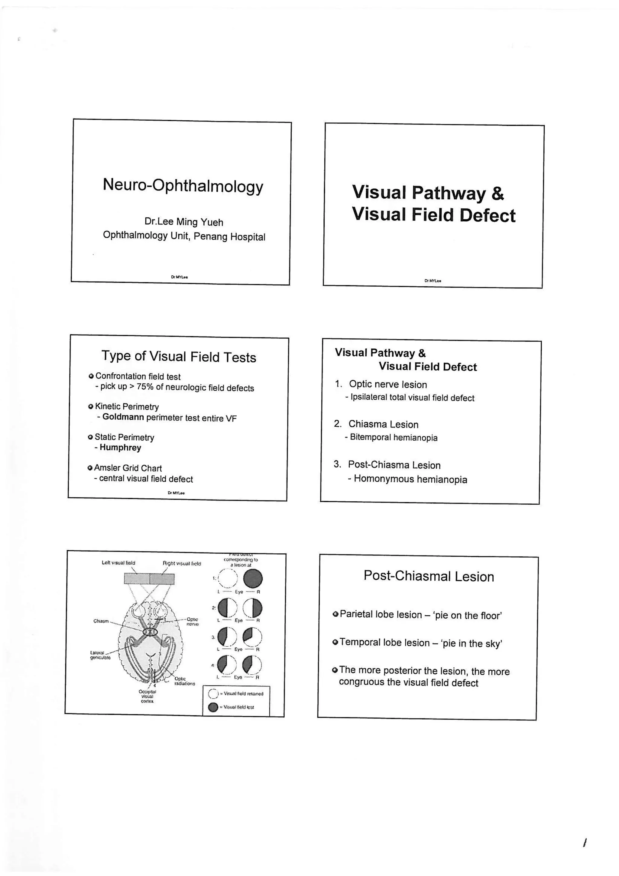Neuro-ophthalmology | PDF
