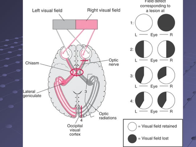 Neuro-ophthalmology | PPT
