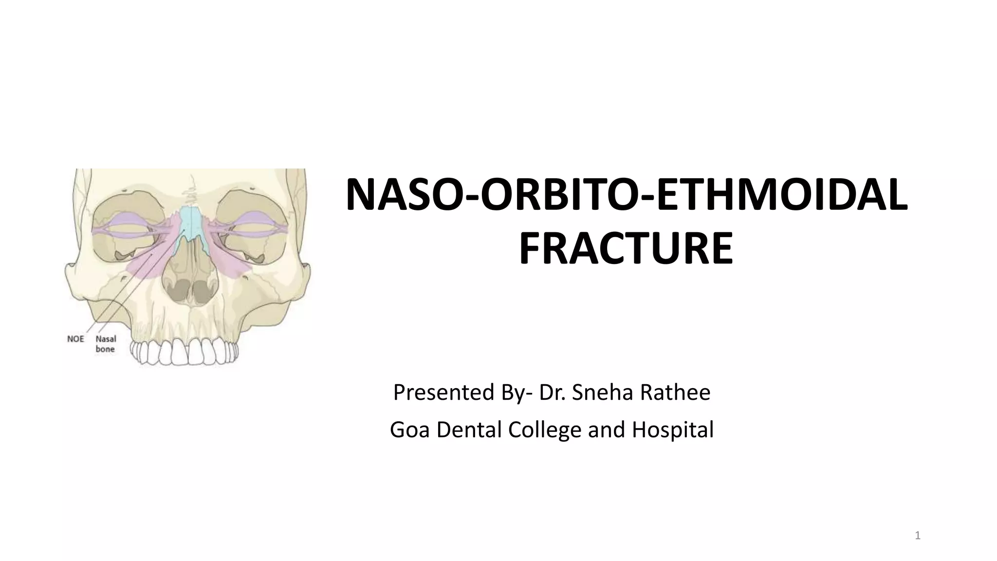5 NOE FRACTURE seminar 5.pptx
