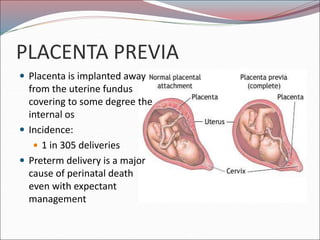 Obstetric Hemorrhage.ppt