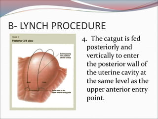 Obstetric Hemorrhage.ppt