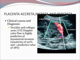 Obstetric Hemorrhage.ppt