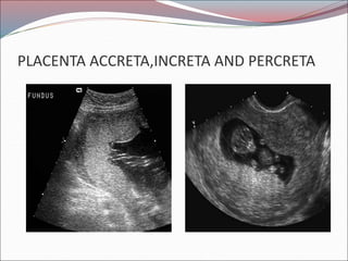 Obstetric Hemorrhage.ppt