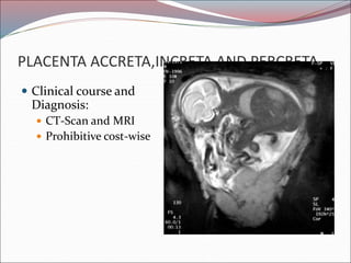 Obstetric Hemorrhage.ppt