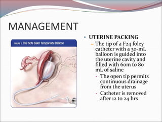 Obstetric Hemorrhage.ppt