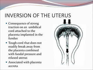 Obstetric Hemorrhage.ppt