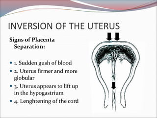 Obstetric Hemorrhage.ppt