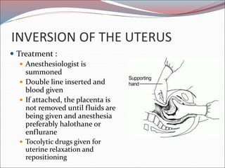 Obstetric Hemorrhage.ppt