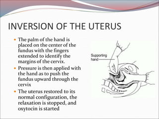 Obstetric Hemorrhage.ppt