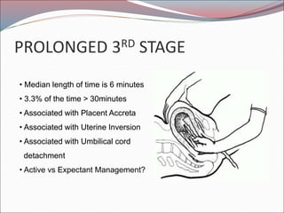 Obstetric Hemorrhage.ppt