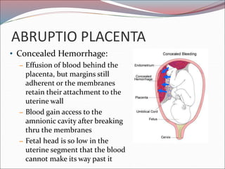 Obstetric Hemorrhage.ppt
