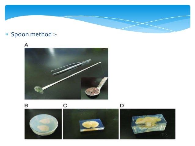 Seed sampling and testing