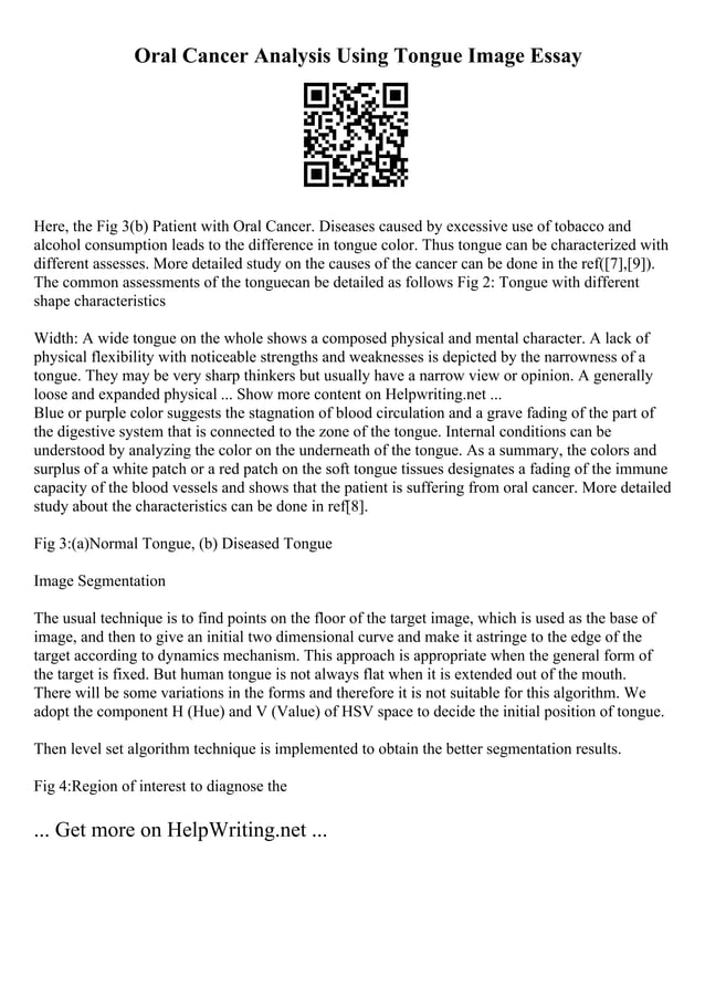 5 Paragraph Definition Essay Example | PDF