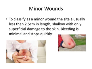 5 provide first aid shock,wounds and bleeding | PPT