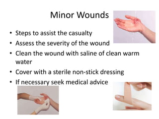 5 provide first aid shock,wounds and bleeding | PPT