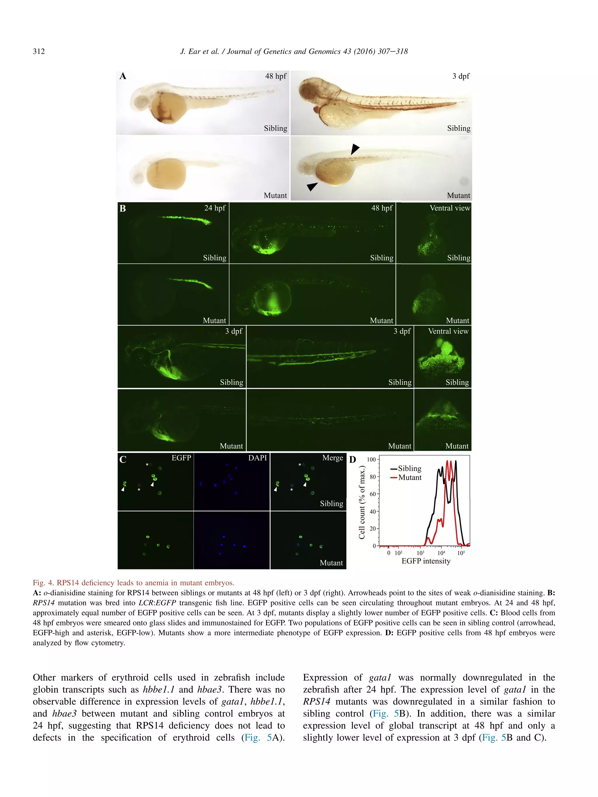 5q syndrome | PDF